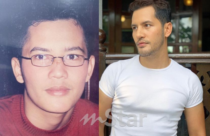 Kongsi foto lama, Aliff Syukri ditanya tentang perubahan pada hidung ...