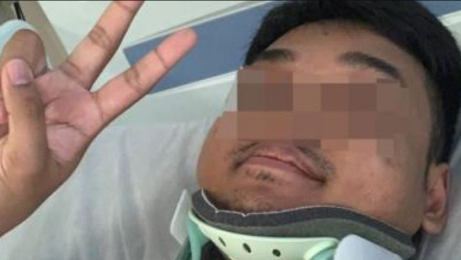 Gara-gara Apple Watch, mangsa langgar lari terselamat - Dunia | mStar