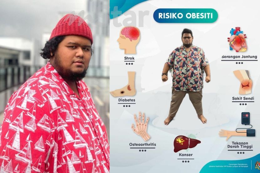 Ramai ‘panas’ foto Bangman dibuat poster obesiti, tapi tuan badan cuma ...