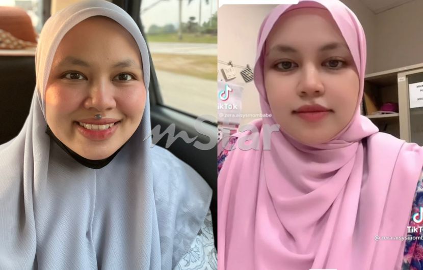Ingatkan guna filter! Netizen terkejut tahi lalat besar di bibir wanita ...
