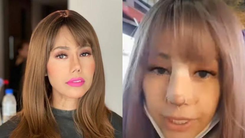 Guna tulang rusuk sendiri ganti silikon, kos pembedahan hidung Lana ...