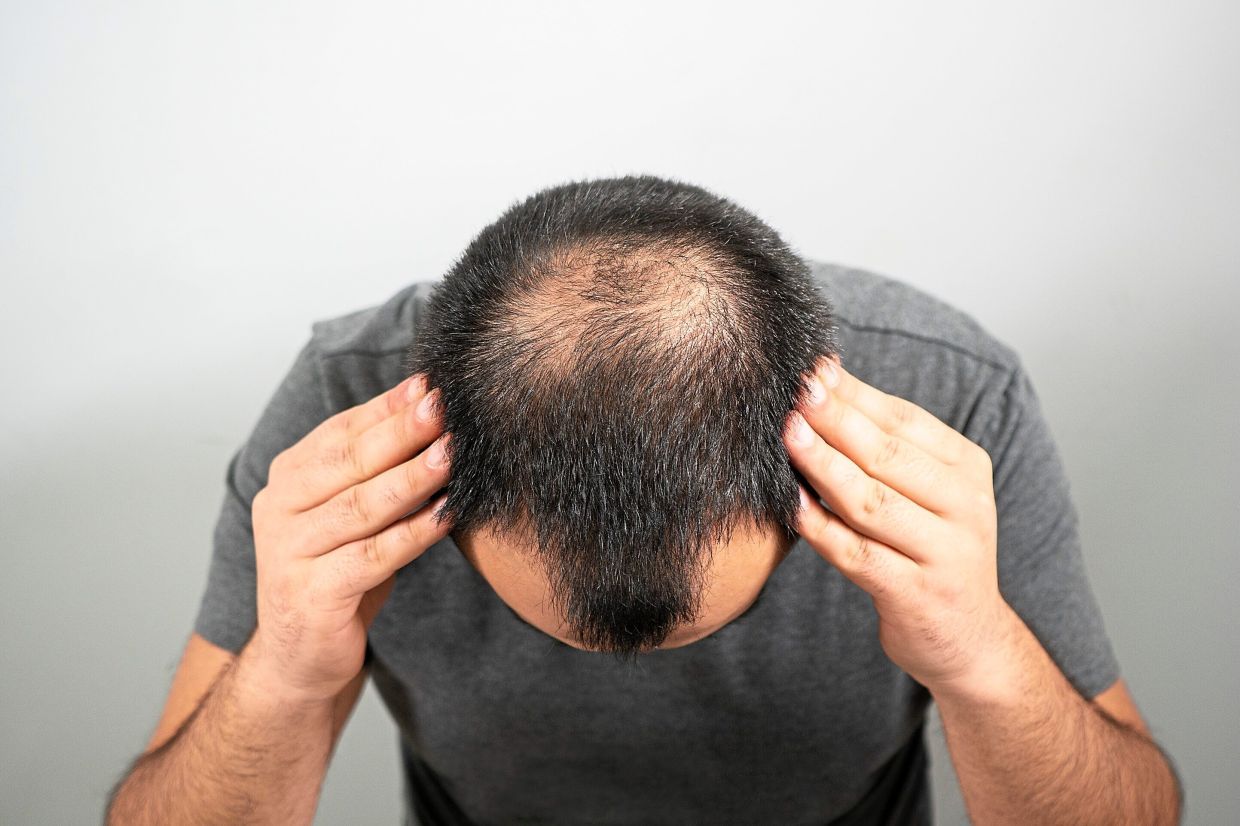 Takut kepala botak? Semak senarai buah ini untuk rambut sihat - Famili ...