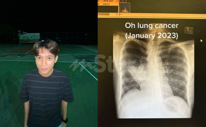 Hidup sihat selama 21 tahun, tiba-tiba didiagnos hidap kanser paru-paru ...