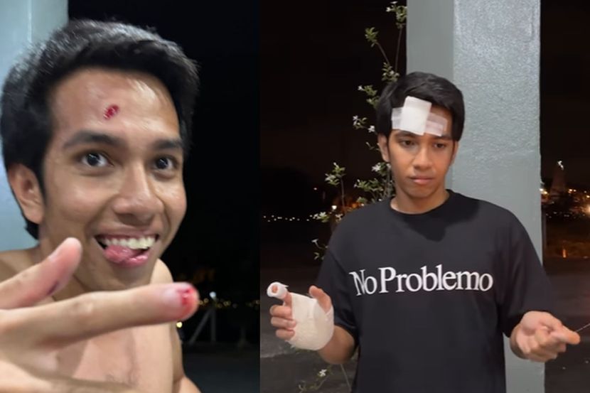 Lambat baling mercun bola, tangan dan dahi Naim Daniel cedera - Hiburan ...