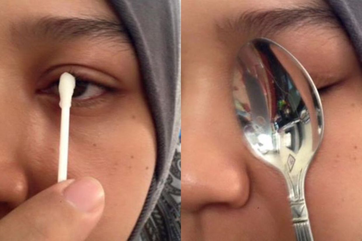 Malunya mata naik ketumbit! Rupanya boleh buat cuba rawat sendiri guna ...