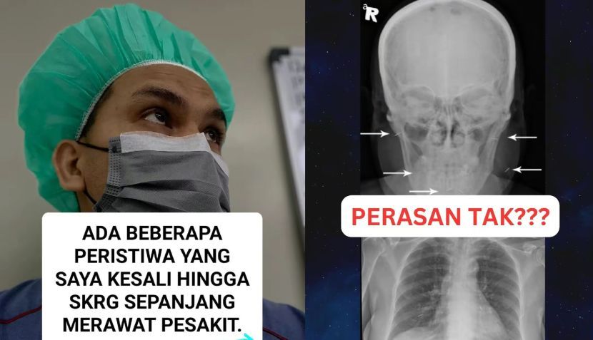 Wanita lumpuh, mengejutkan buat x-ray nampak susuk di 4 bahagian badan ...