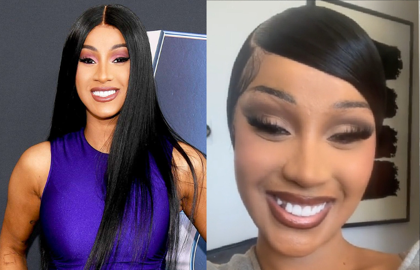 Veneer tercabut lepas kunyah roti keras, Cardi B buat ‘live‘ tunjuk ...