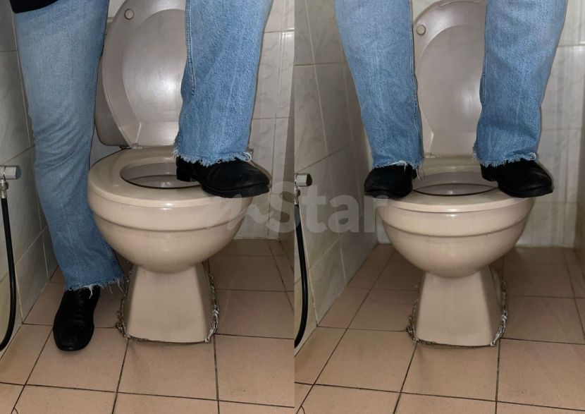 Padah mencangkung atas tandas duduk... Punggung cedera dicucuk seramik ...