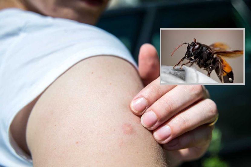 Lambat rawat boleh bawa maut! Lelaki ini kongsi 3 petua orang lama ...