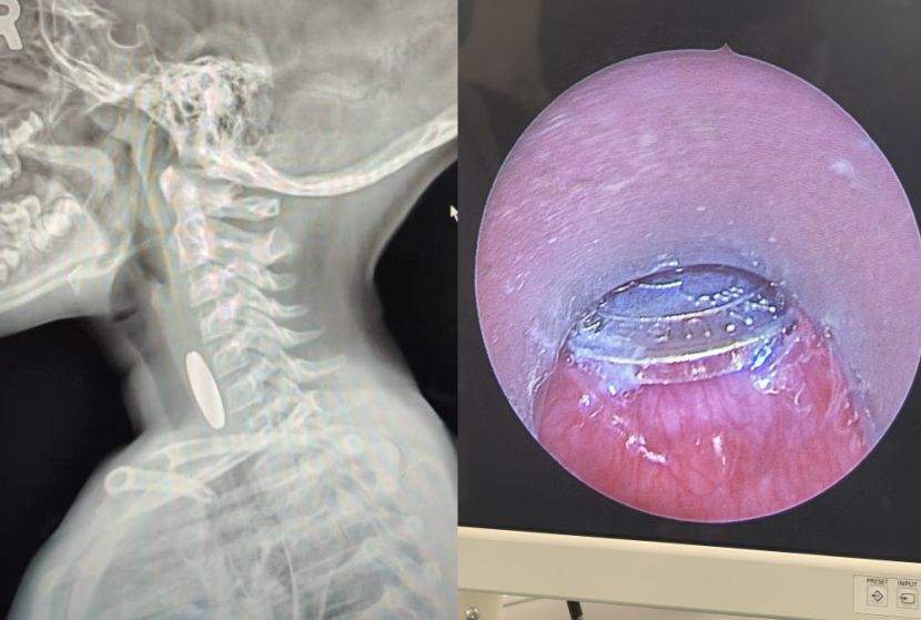 Doktor tinggal solat tarawih, bergegas ke dewan bedah selamatkan budak ...