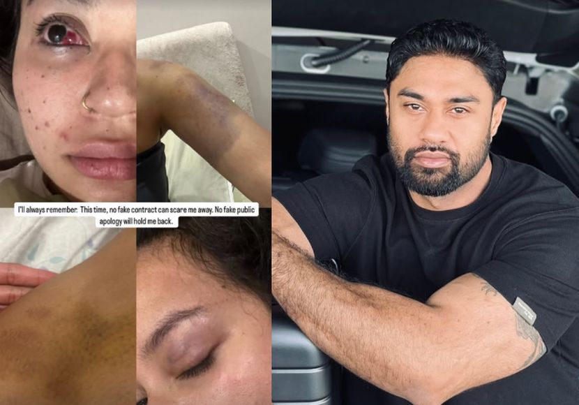 Bekas kekasih Ammar Alfian dedah ada bukti kena pukul, dipaksa ‘sign’ perjanjian palsu - Sensasi ...